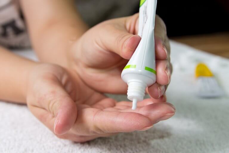 Treatment and Management of Atopic Dermatitis | Allergy and Clinical