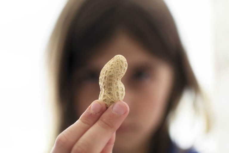 Peanut Allergy in Children | Allergy and Clinical